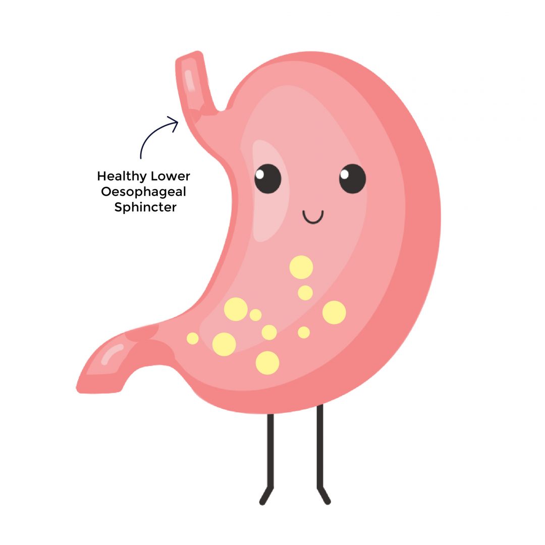 Tips For Managing Reflux - A Little Bit Yummy