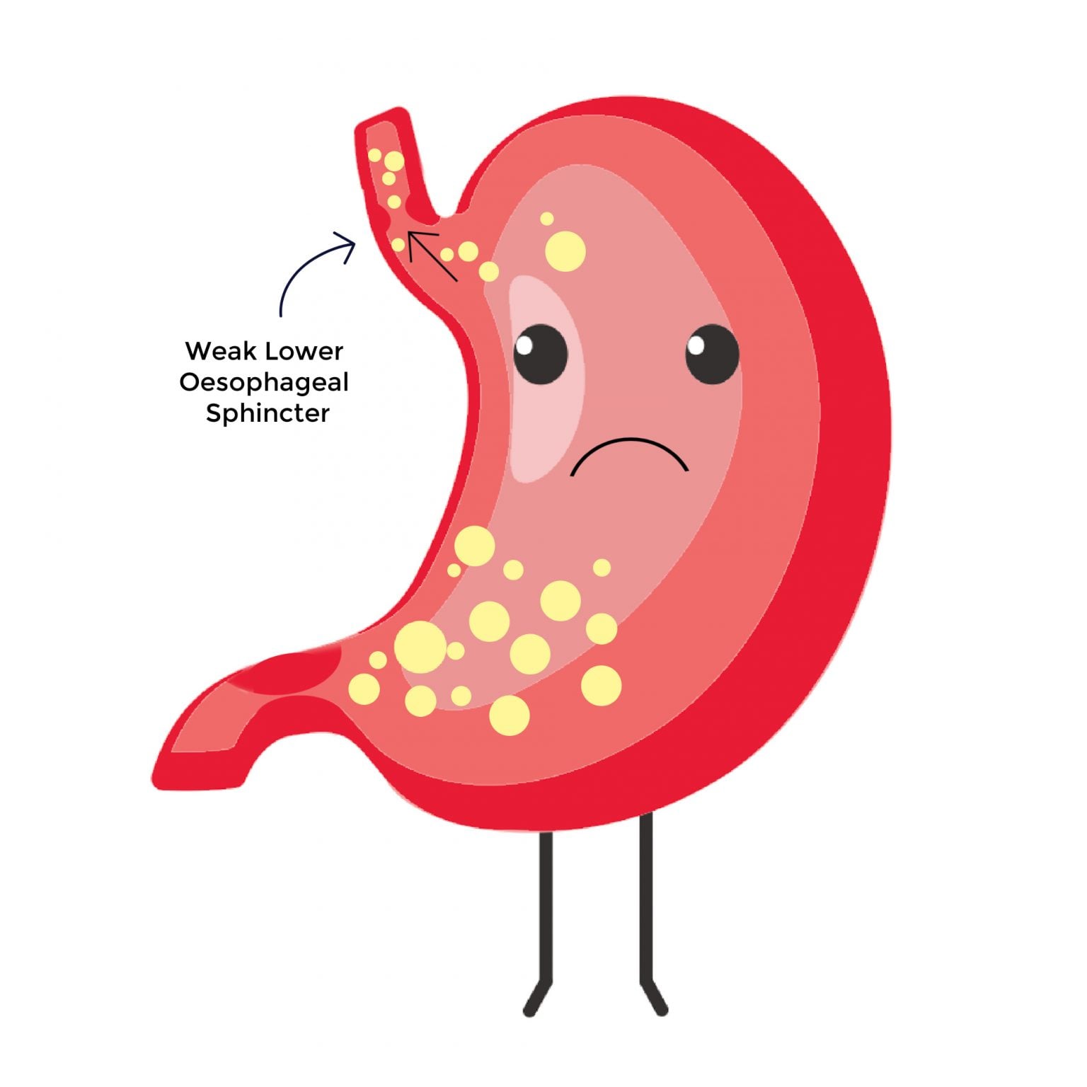 Tips For Managing Reflux - A Little Bit Yummy